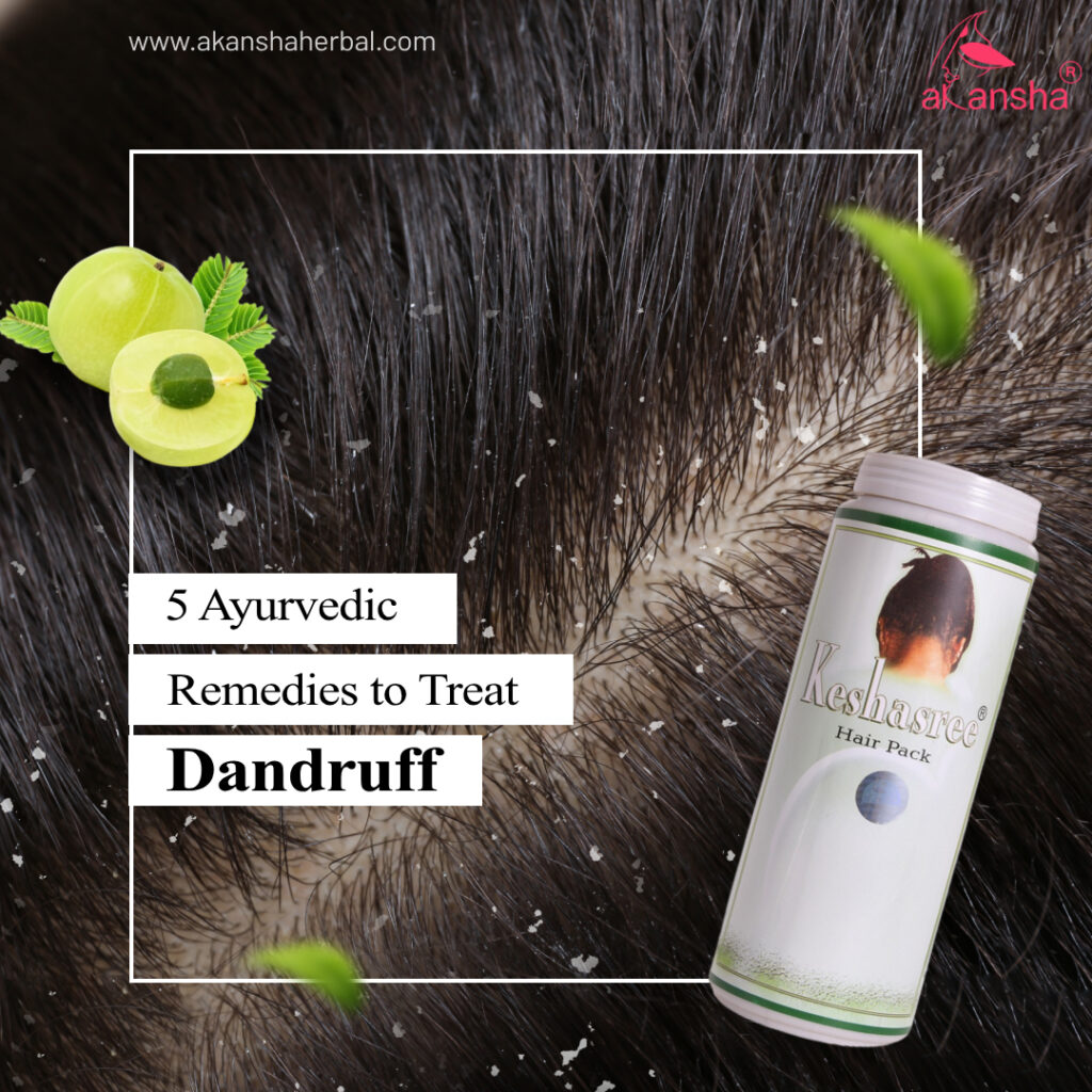 Excellent Ayurvedic Solutions to Eliminate Dandruff